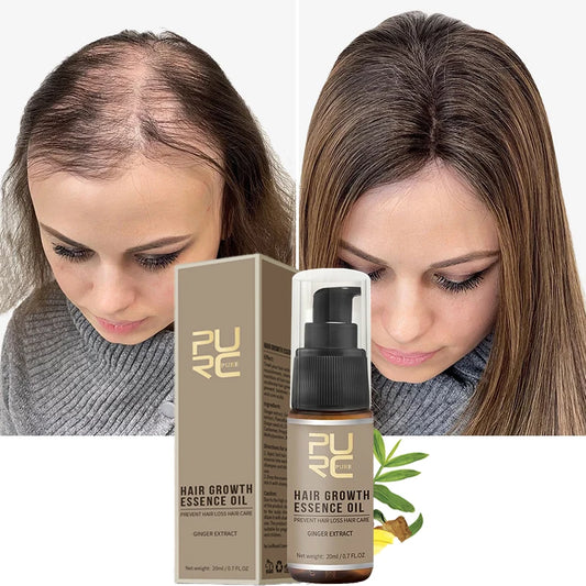 Top Hair Treatment Products Revitalize Your Hair Lipo Lab South Africa
